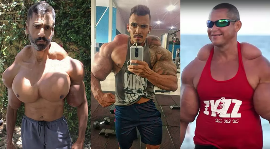 7 Υποτιθέμενοι «Synthol Freaks» που πήγαν πολύ μακριά