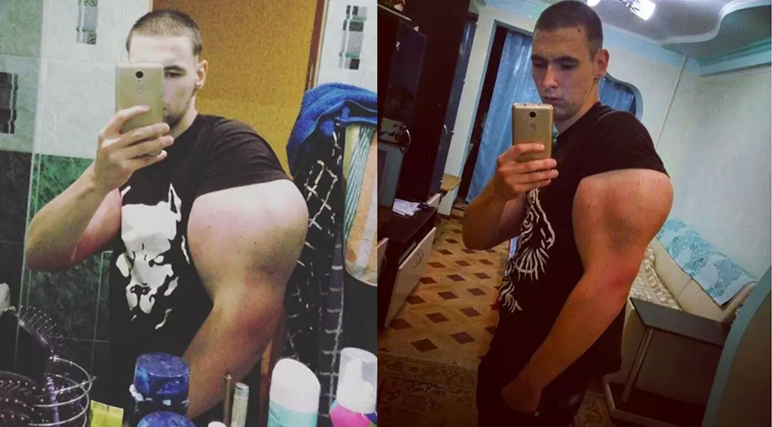 Synthol Freak: Kirill Tereshin