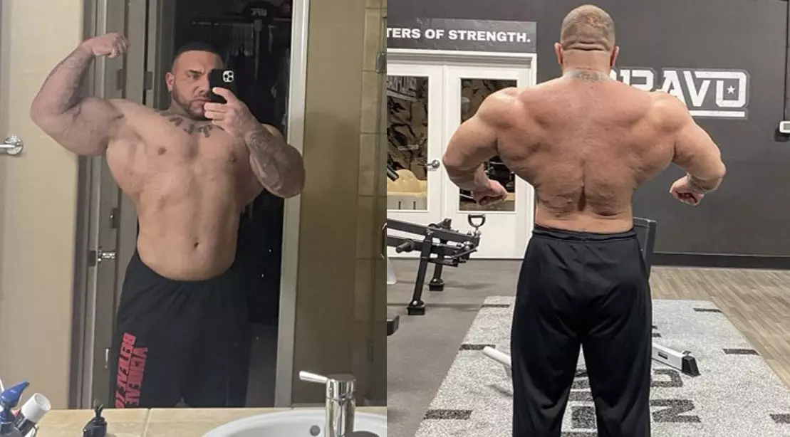 IFBB Bodybuilder Dominick Cardon masalah kulit alatan racun merkuri