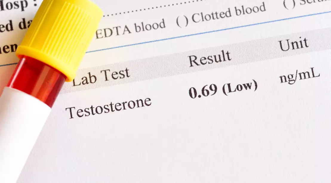 Testosteron-Blod-Test-Resultater-Lavt-hormon